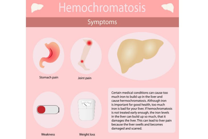 Facts on Hemochromatosis - ActiveBeat