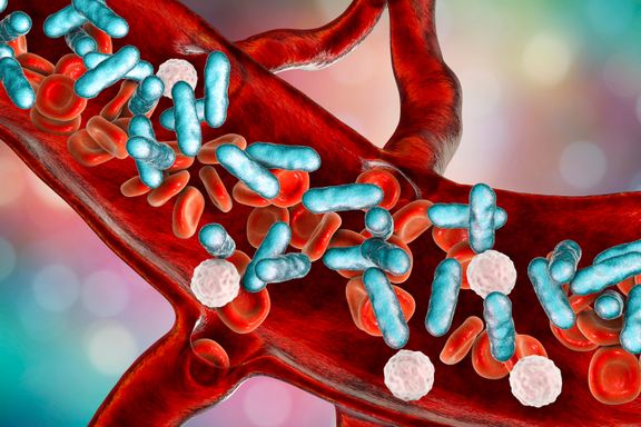 long term effects sepsis Archives - ActiveBeat