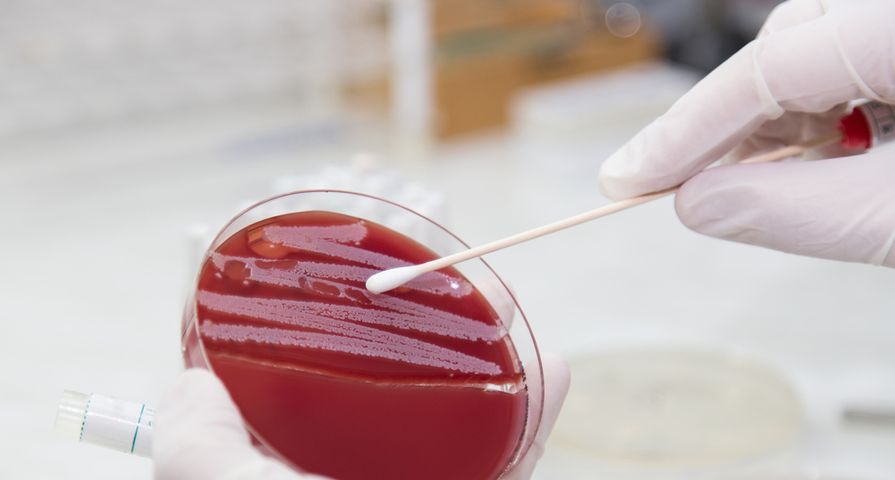 The Causes, Symptoms, and Treatment for MRSA - ActiveBeat