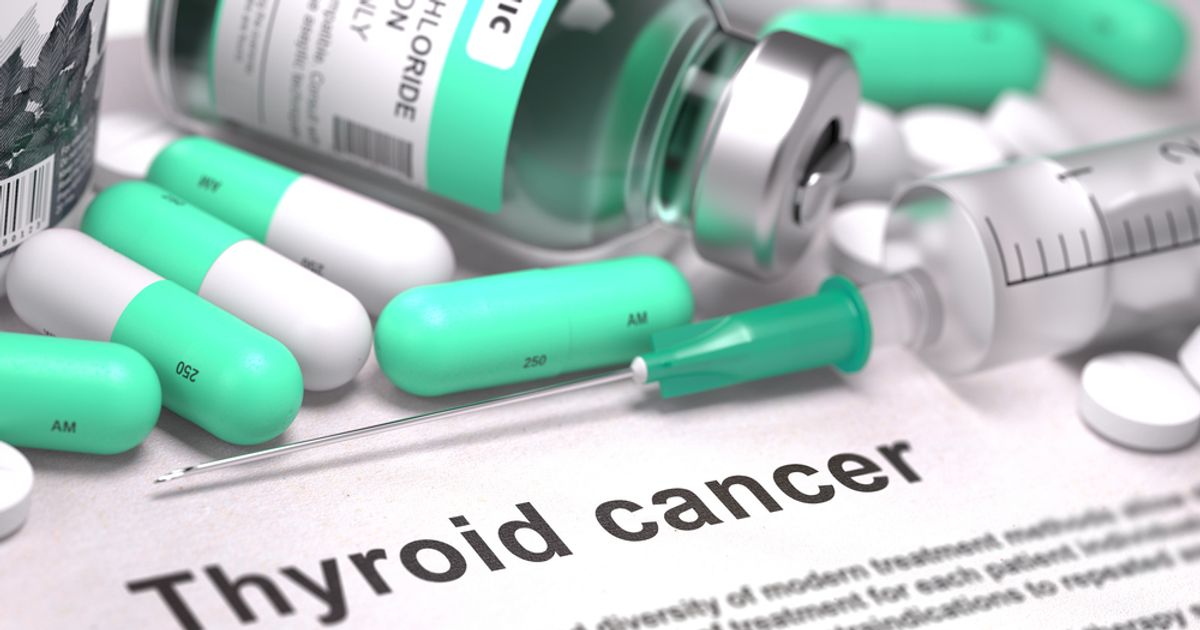 10 Need to Know Thyroid Cancer Facts - ActiveBeat