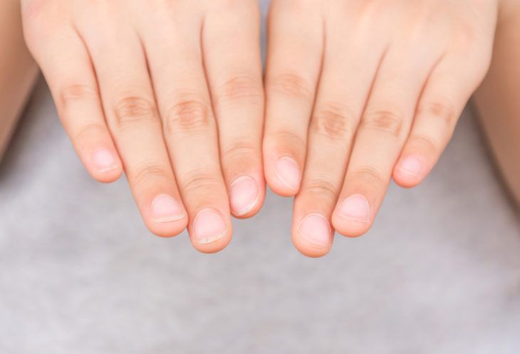 Common Health Problems Related to Fingernails - ActiveBeat