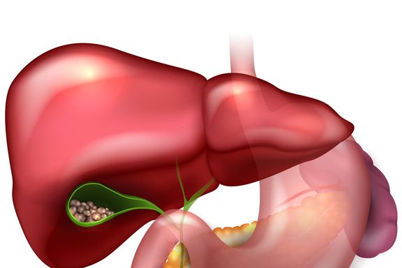 Signs and Symptoms You May Have a Gallbladder Problem - ActiveBeat