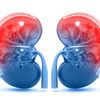 Chronic Kidney Disease: Common Symptoms of CKD - ActiveBeat