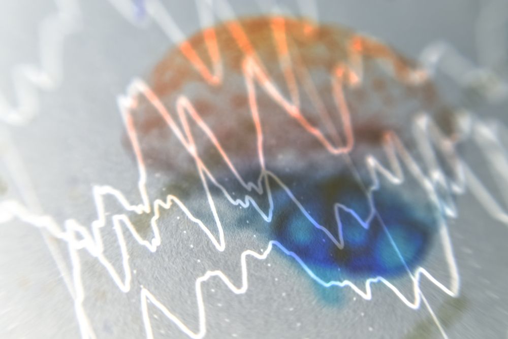 Most Common Seizure Triggers Activebeat