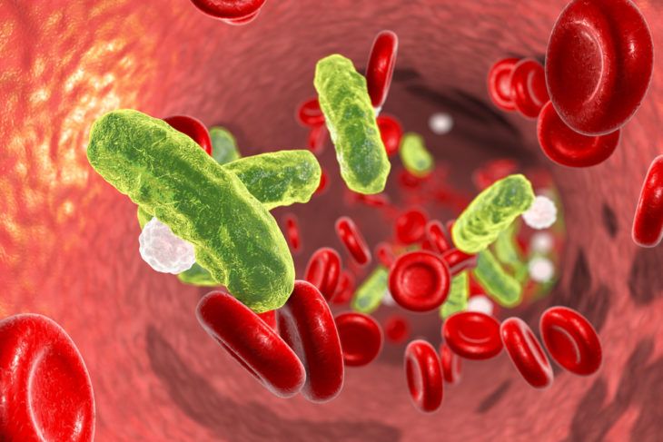 The Signs, Symptoms, and Causes of Sepsis - ActiveBeat