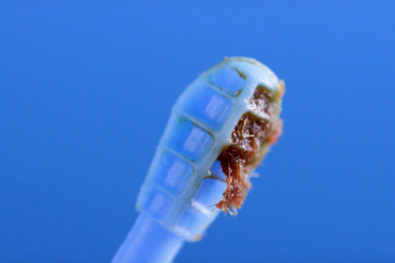 Whooshing Sound in Ear? It Might Be Pulsatile Tinnitus - ActiveBeat