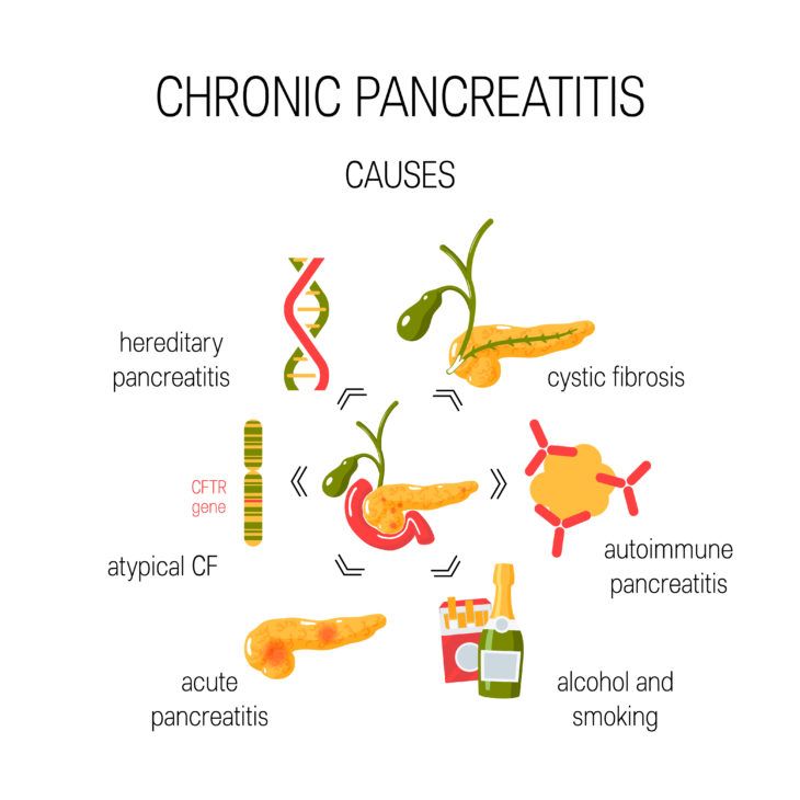 Acute Pancreatitis vs. Chronic Pancreatitis: What's The Difference ...