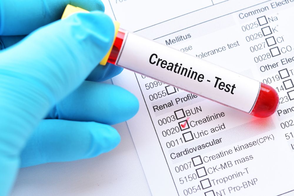 What Should Your Creatinine Levels Be at Every Age - ActiveBeat
