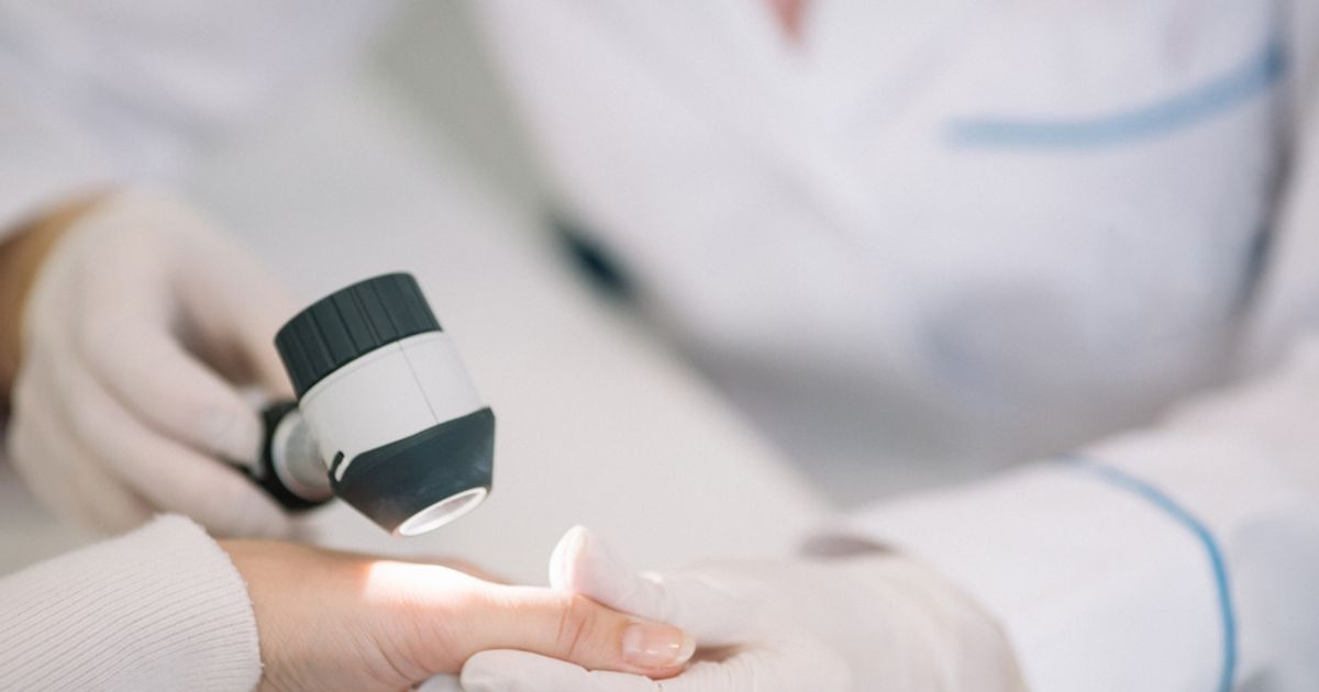 Dermatitis: Symptoms, Types, Causes, and Treatment - ActiveBeat